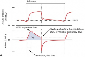 Mechanical Ventilation in Acute Respiratory Failure – Guidelines - The ...