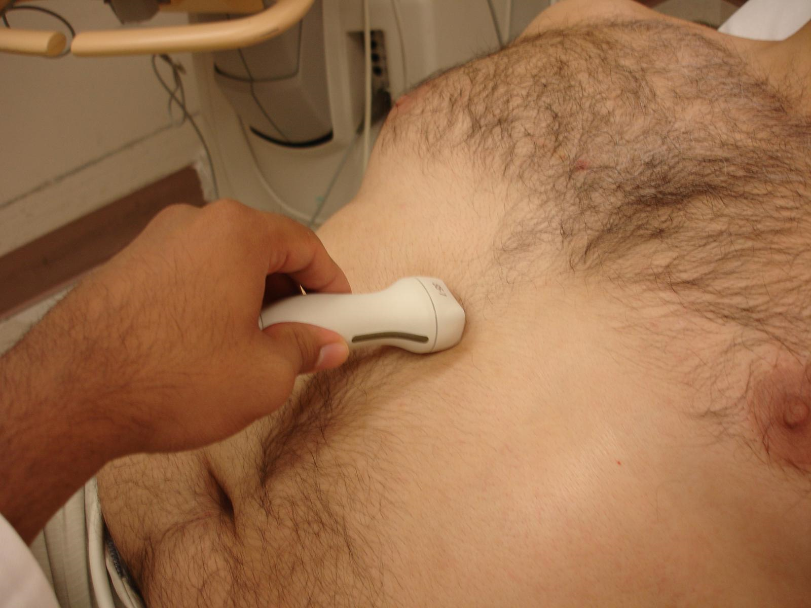 Abdominal ultrasound – eFAST – method, indications and interpretation ...