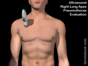 Abdominal ultrasound – eFAST – method, indications and interpretation ...