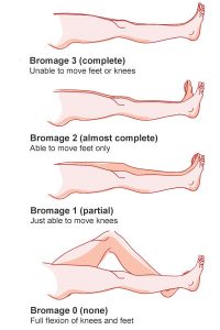 Spinal anesthesia – technique, indications and clinical use - The ...