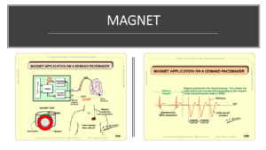 Pacemaker Overview: Device and Electrodes Explained - The Anesthesia Guide