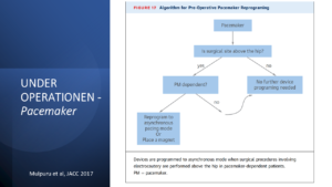 Pacemaker Overview: Device and Electrodes Explained - The Anesthesia Guide