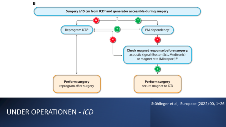 Pacemaker Overview: Device and Electrodes Explained - The Anesthesia Guide