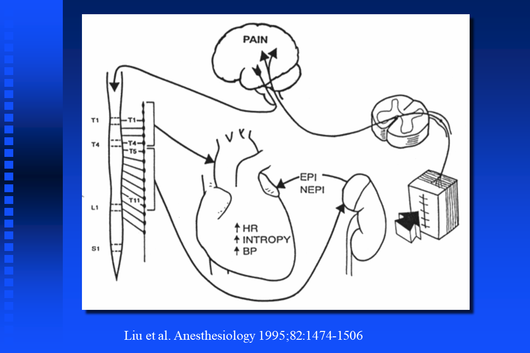 Cardiothoracic Anesthesia for Heart Surgery - GUCH - Pacemaker - The ...
