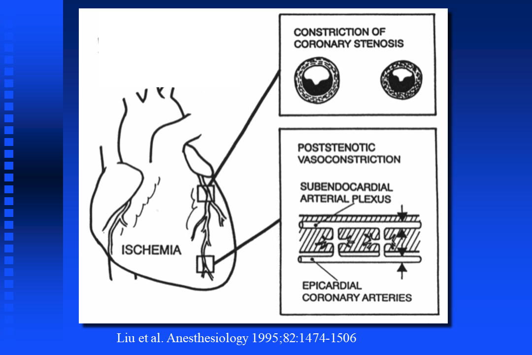 Cardiothoracic Anesthesia for Heart Surgery - GUCH - Pacemaker - The ...