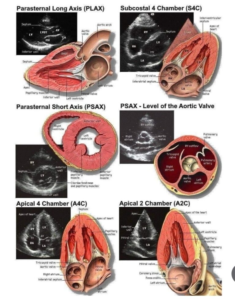 Echocardiography – Cardiac Ultrasound, Indications and Uses - The ...