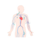 Central venous catheter – CVC insertion – indications, technique and ...