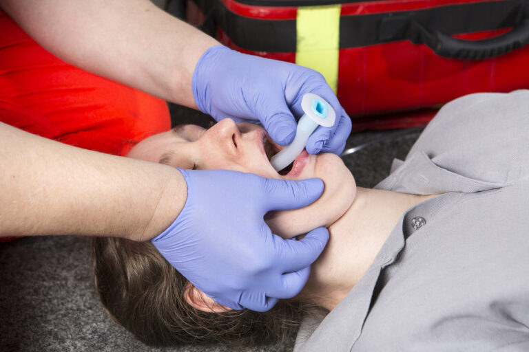 Airway Management in Anesthesia and Emergency Medicine - Intubation ...