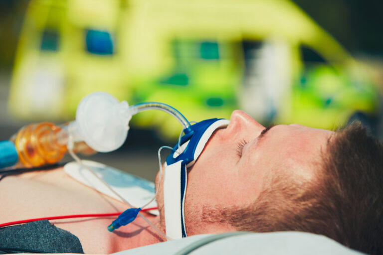 Airway Management in Anesthesia and Emergency Medicine - Intubation ...