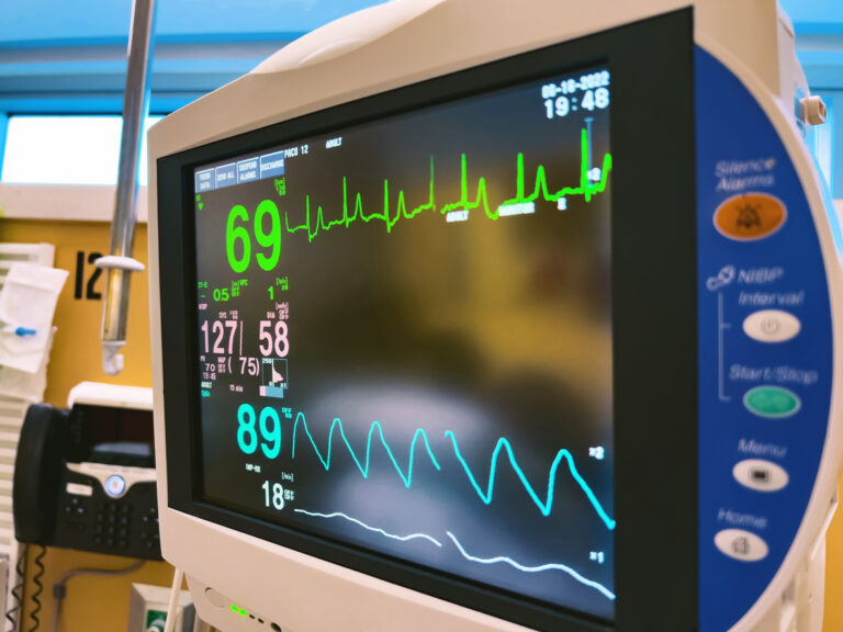General Anesthesia – Clinical Practice, Safety and Monitoring - The ...