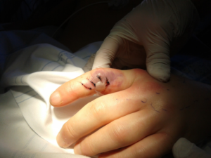 Snakebite – Diagnosis and Treatment of Snake Envenomation - The ...