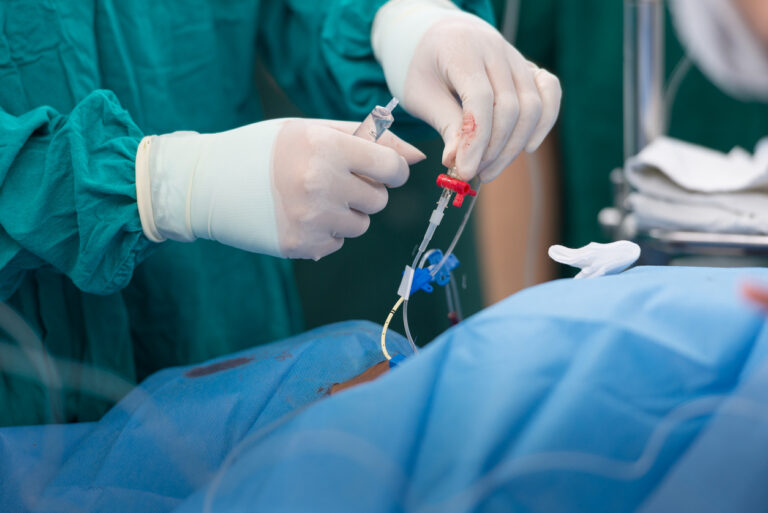 Central venous catheter – CVC insertion – indications, technique and ...
