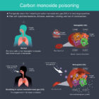 Smoke and chemical inhalation toxicity and nerve agents - The ...