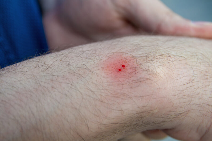 Snakebite – Diagnosis and Treatment of Snake Envenomation - The ...