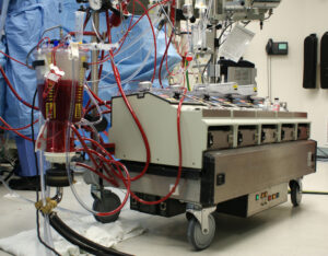 Cardiothoracic Anesthesia for Heart Surgery - GUCH - Pacemaker - The ...