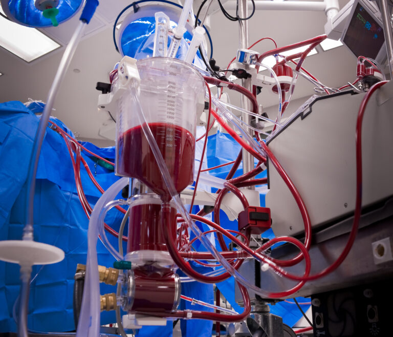 Cardiothoracic Anesthesia for Heart Surgery - GUCH - Pacemaker - The ...