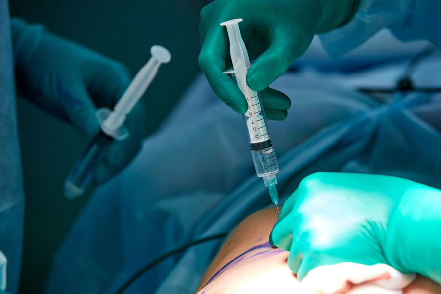 Local Anesthetic Drugs – Safe Use, Toxicity and Maximum Doses - The ...