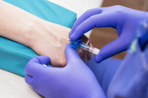Peripheral Venous Catheter – Indications, Insertion and Use - The ...