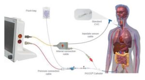 Central Hemodynamics – Clinical Methods and Indications - The ...