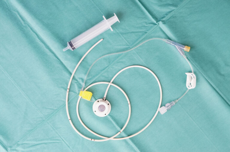 Central venous catheter – CVC insertion – indications, technique and ...