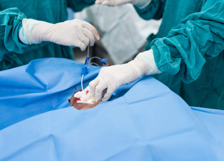 Central venous catheter – CVC insertion – indications, technique and ...