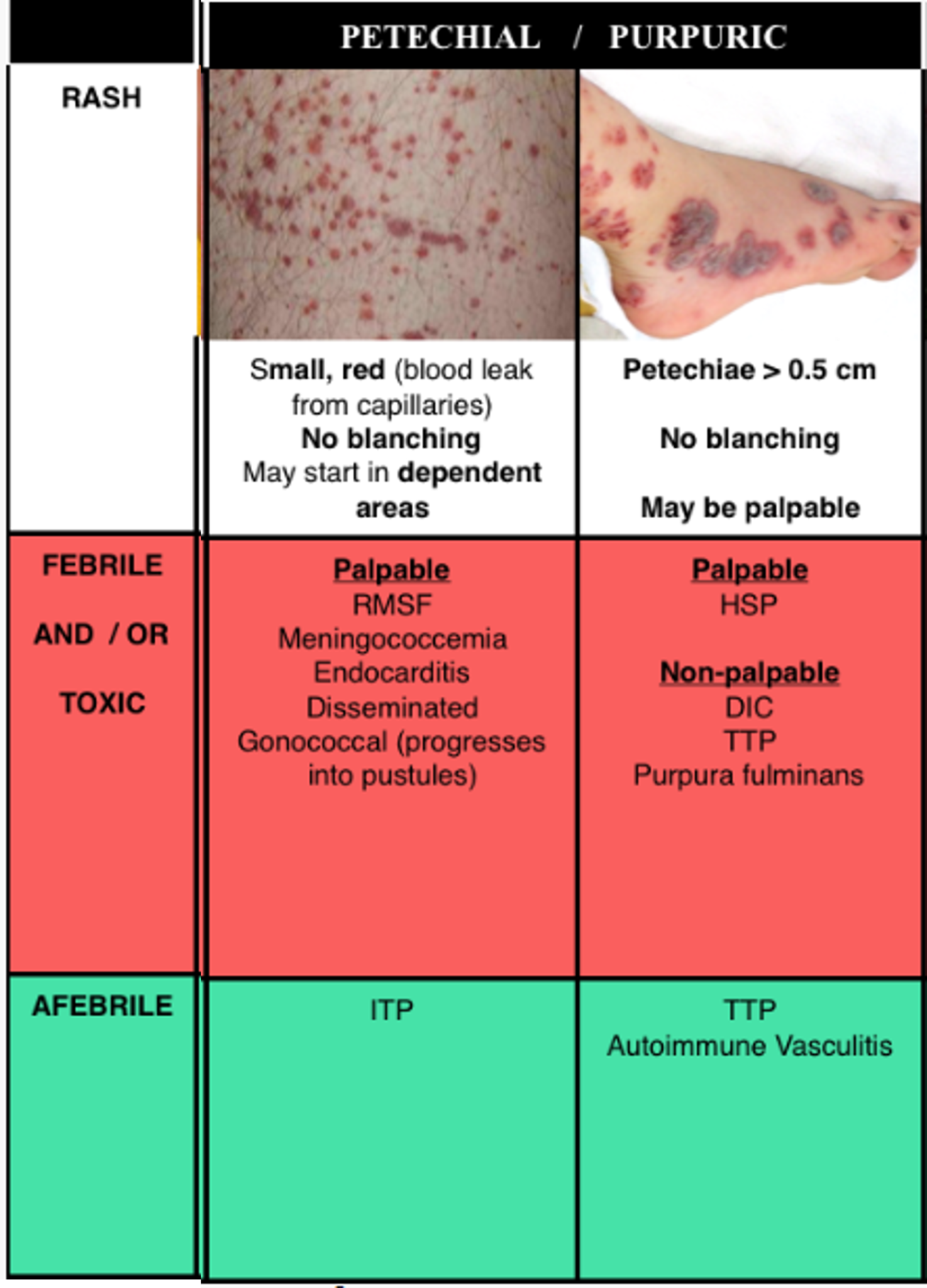Thrombocytopenia – Diagnosis and Treatment of ITP, TTP and HIT - The ...