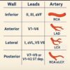 ECG and Heart Rhythm – Basic Interpretation and Common Arrhythmias ...