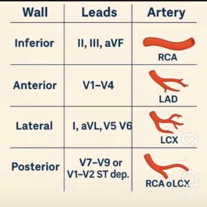 ECG and Heart Rhythm – Basic Interpretation and Common Arrhythmias ...