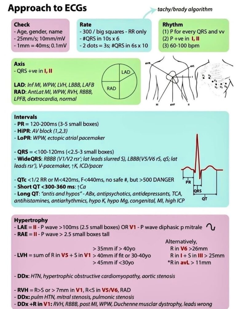 ECG and Heart Rhythm – Basic Interpretation and Common Arrhythmias ...