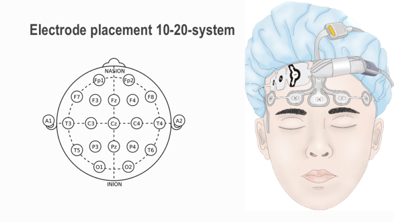 Electroencephalography (EEG) – Interpretation and Clinical Use - The ...