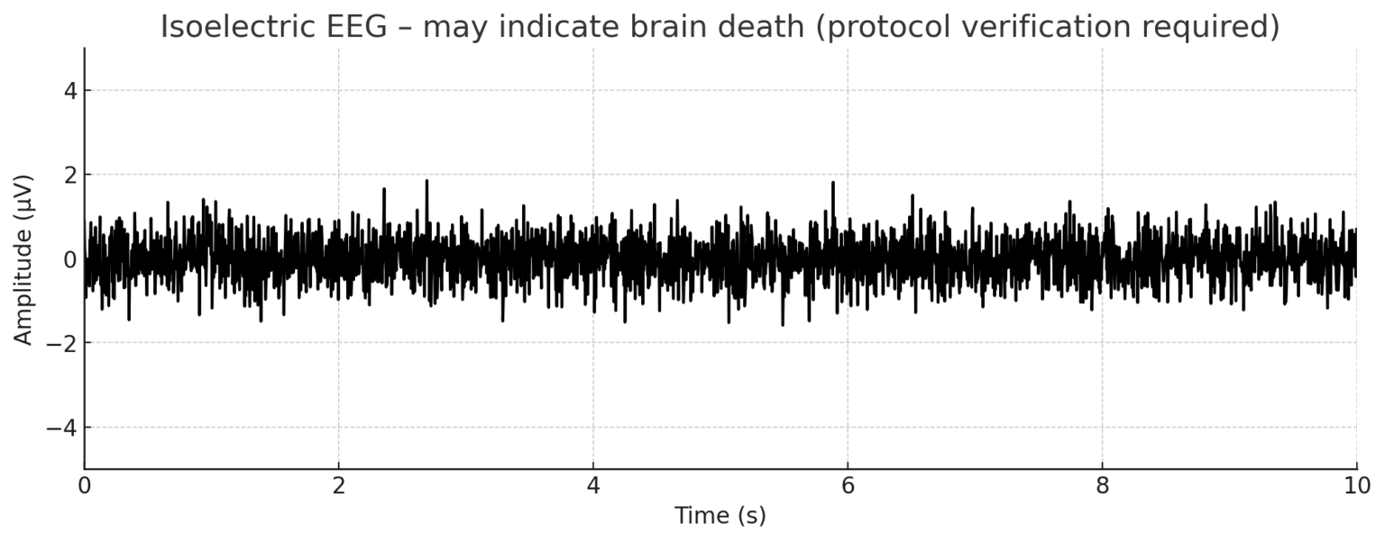 Electroencephalography (EEG) – Interpretation and Clinical Use - The Anesthesia Guide
