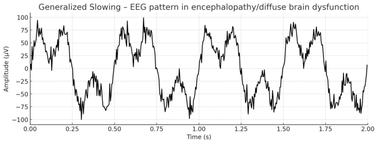 Electroencephalography (EEG) – Interpretation and Clinical Use - The ...