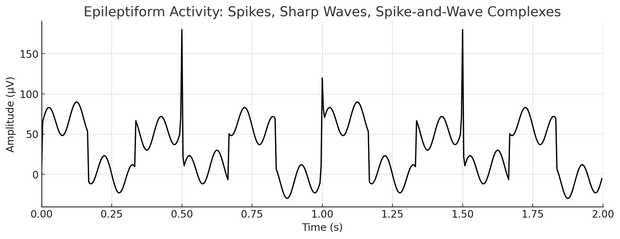 Electroencephalography (EEG) – Interpretation and Clinical Use - The ...