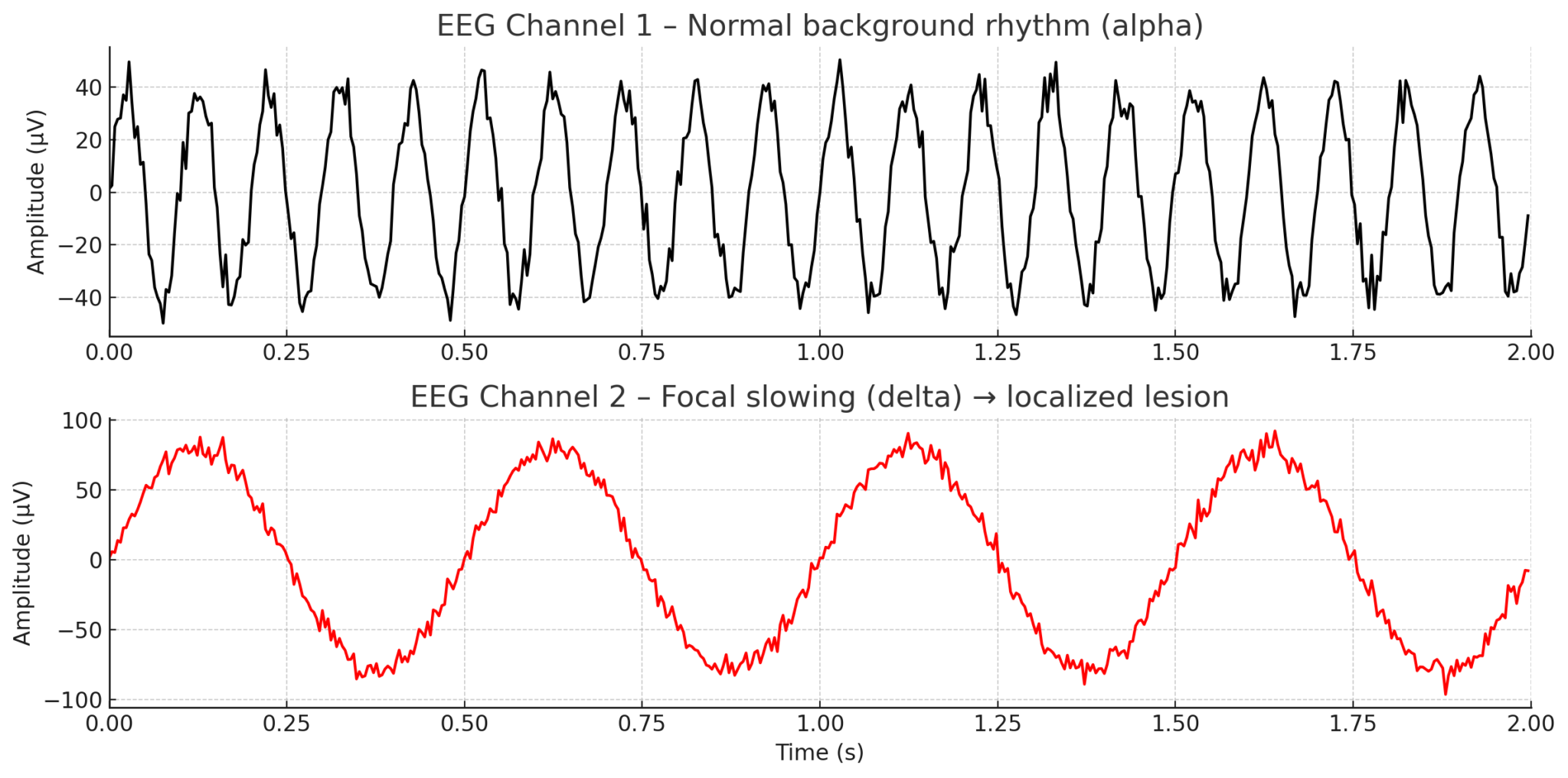 Electroencephalography (EEG) – Interpretation and Clinical Use - The Anesthesia Guide