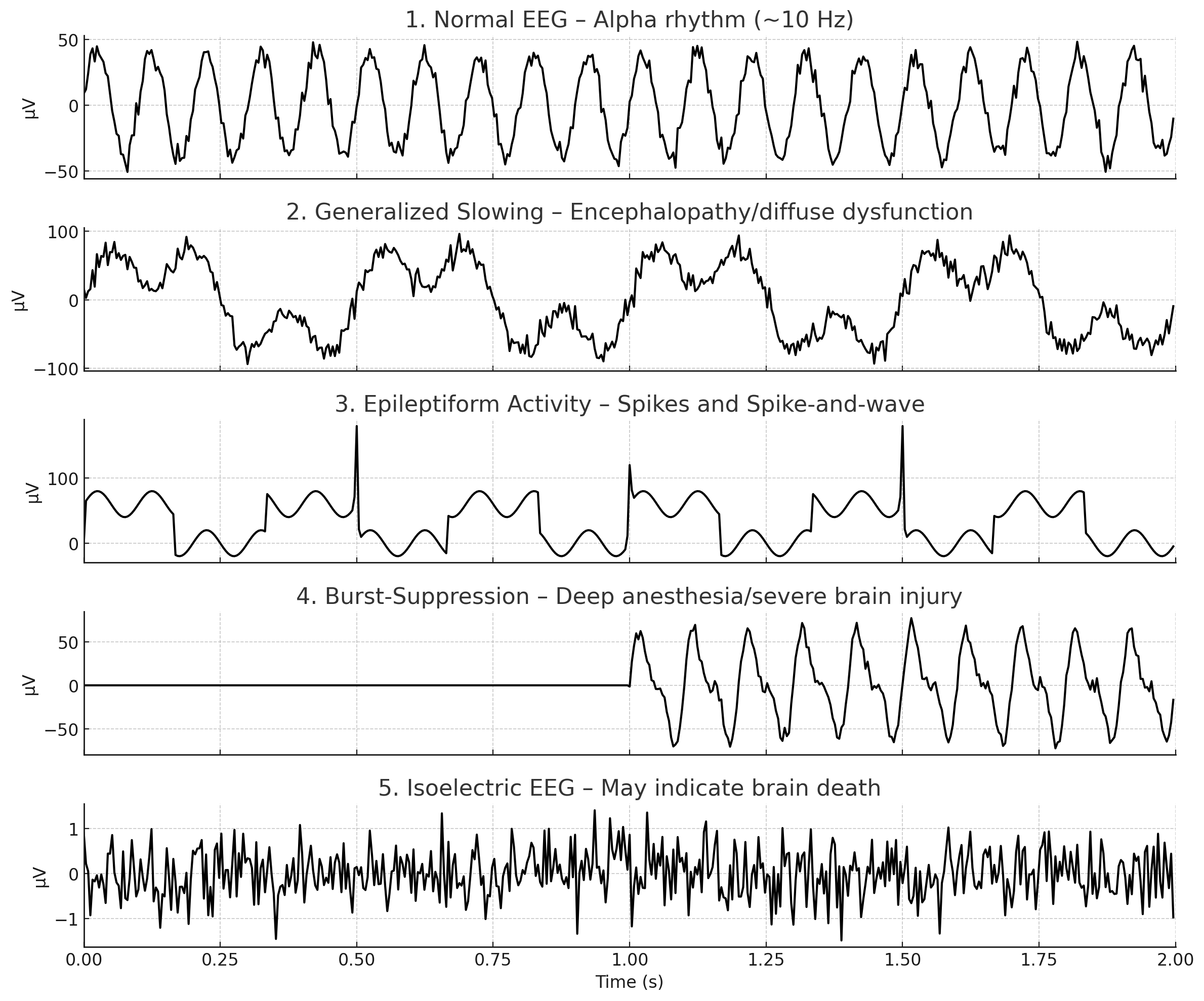 Electroencephalography EEG Interpretation And Clinical Use The