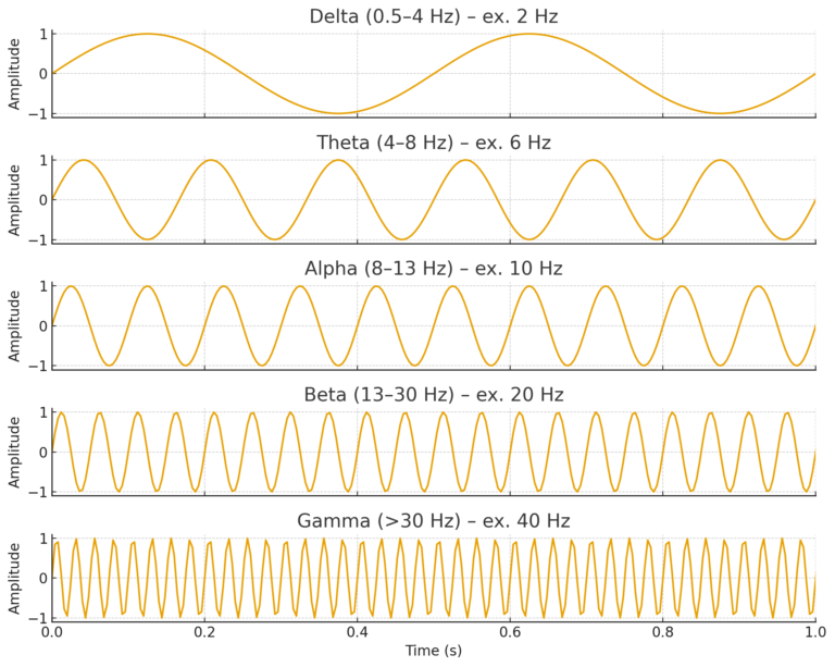 Electroencephalography (EEG) – Interpretation and Clinical Use - The ...